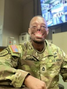 Army: What Happened To Randy Adams? Injury and Burns, Car Accident Update